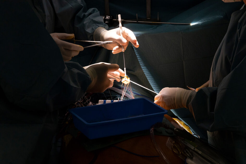 The operations - Cardiothoracale Chirurgie